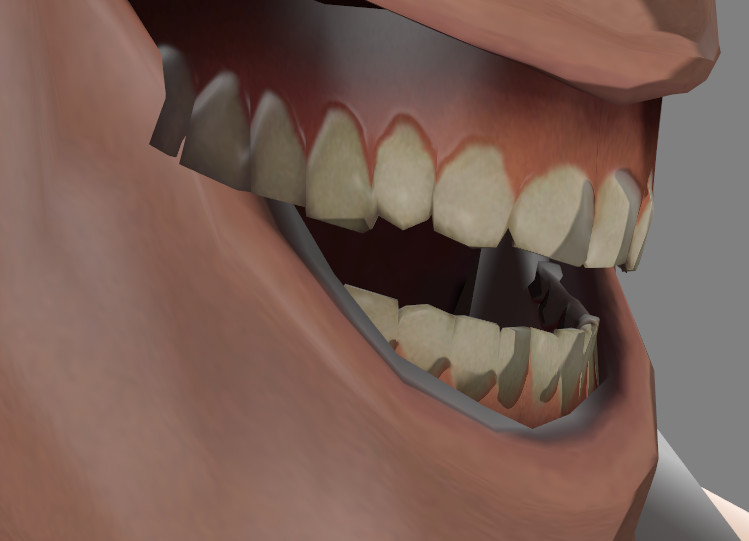 Evil Medic Work In Progress for Team Fortress 2 | TF2 Works In Progress